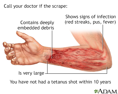Scrape Scrape